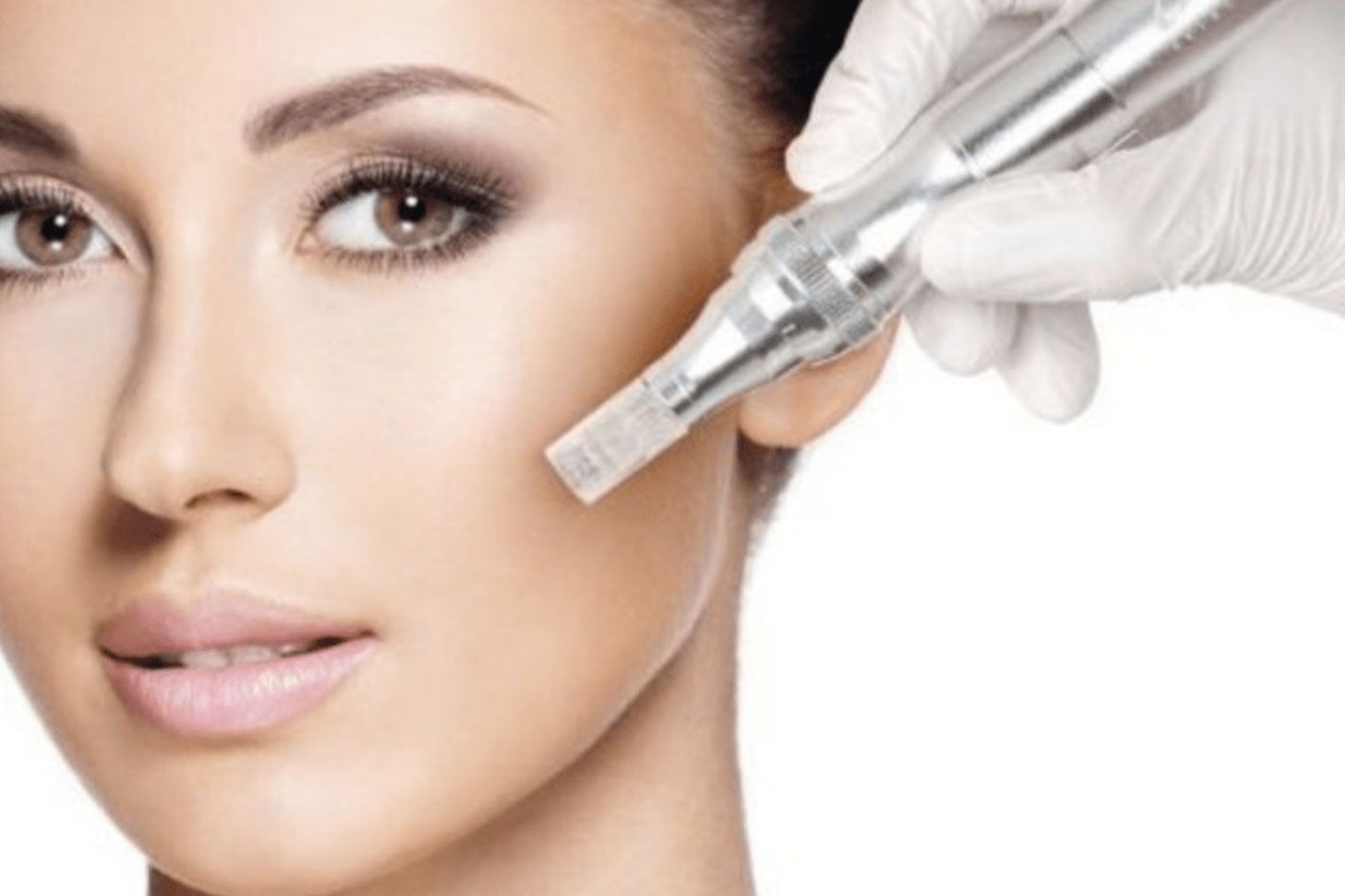 RF Microneedling Amsterdam | Unicare Cosmetische Kliniek